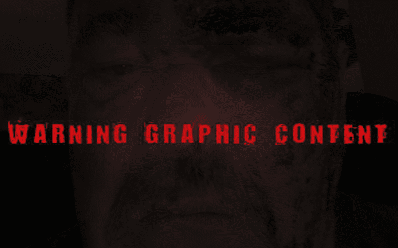 WWE Hall Of Famer Jim Ross Suffers Gruesome Injuries After Falling On A ...