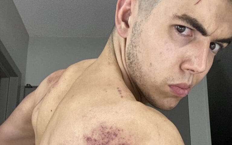 Sammy Guevara Shows Off Mangled Arm After AEW Blood & Guts Match