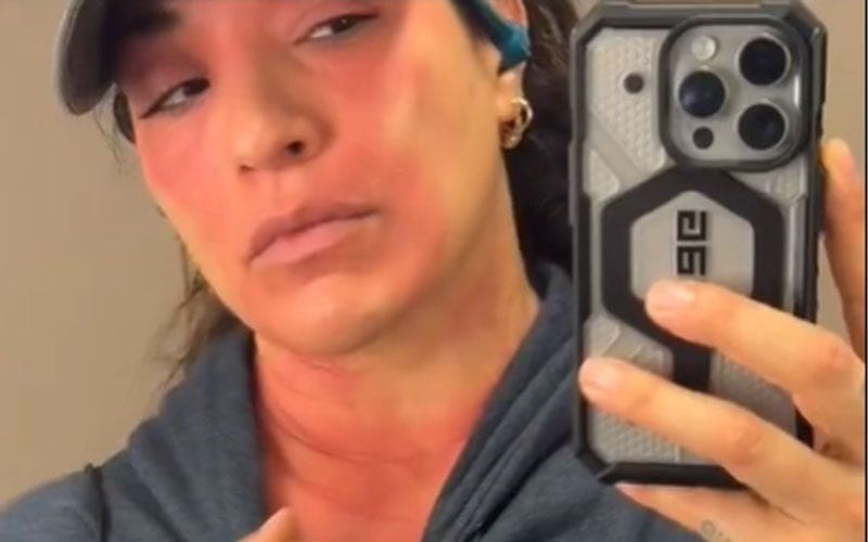 Raquel Rodriguez Chronicles Healing Journey After Mast Cell Activation ...