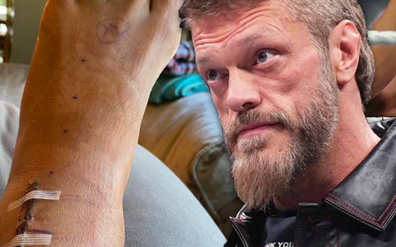 Adam Copeland Provides Update Following Surgery To His Leg