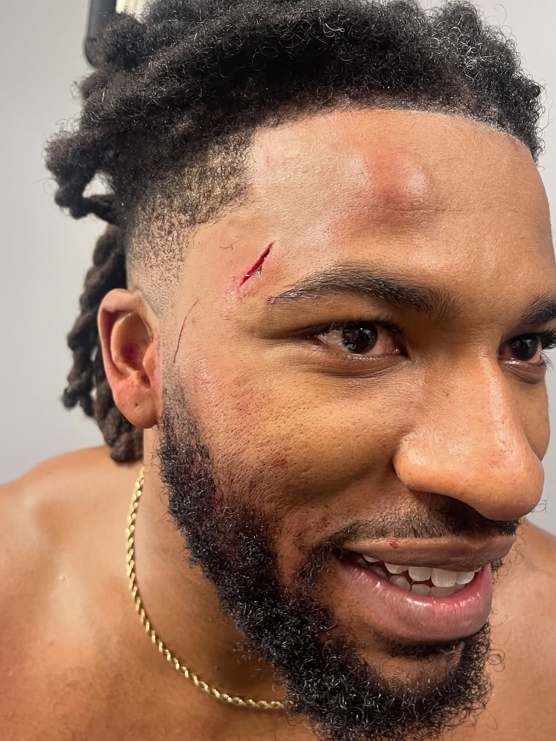 Trick Williams Suffers Nasty Head Injury After Brutal Barricade Spot on ...